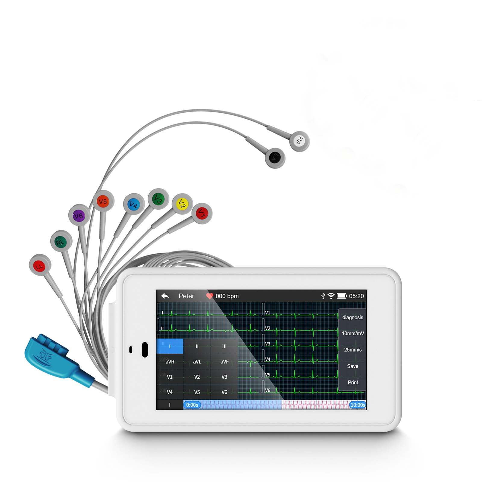 Mobile 6/12-Lead EKG/ECG Machine Fits into Your Pocket, with Auto Interpretation, Wirelessly ...